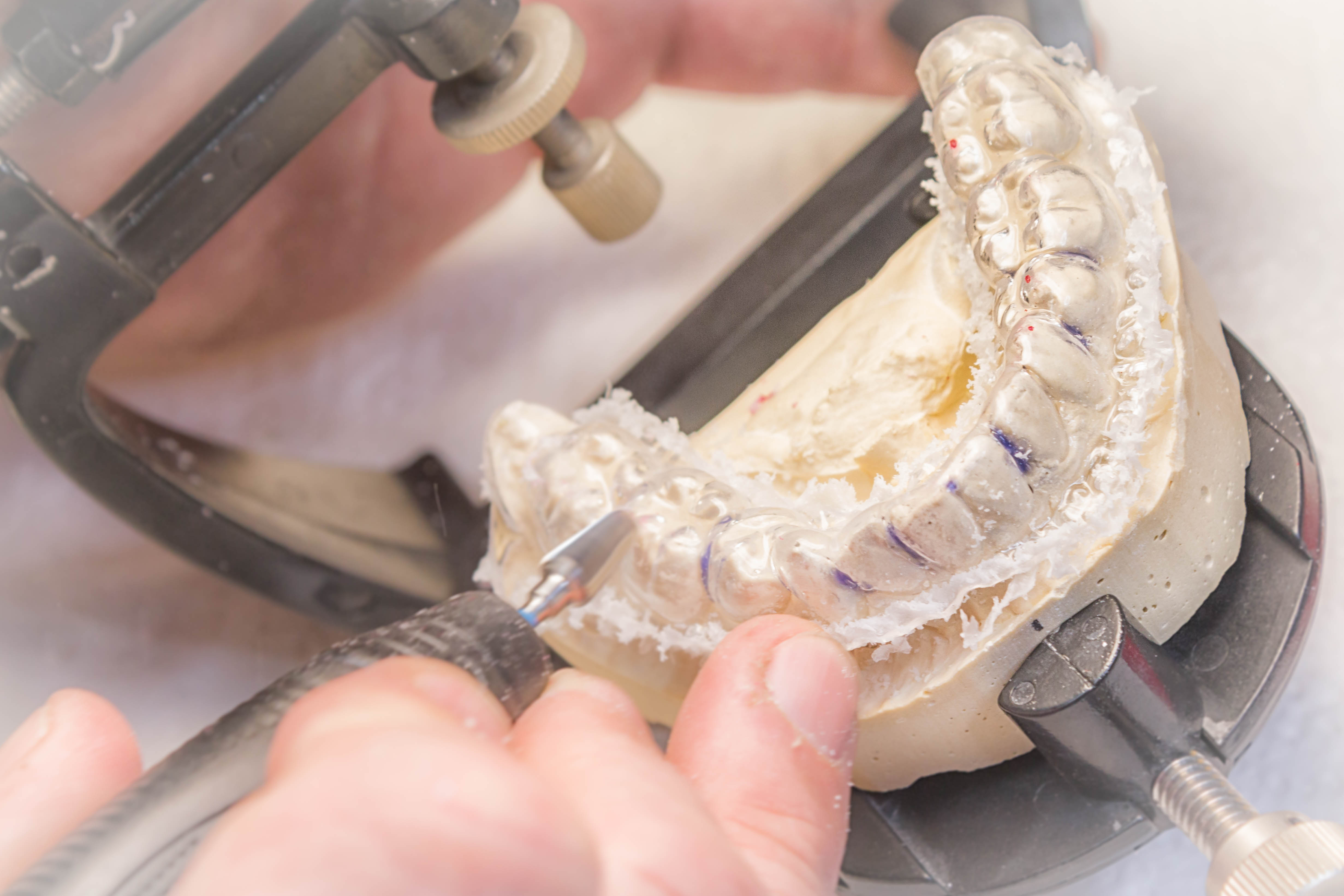 Zahnersatz (Prothetik) – Zahnarztpraxis Dr. Mühlenbeck